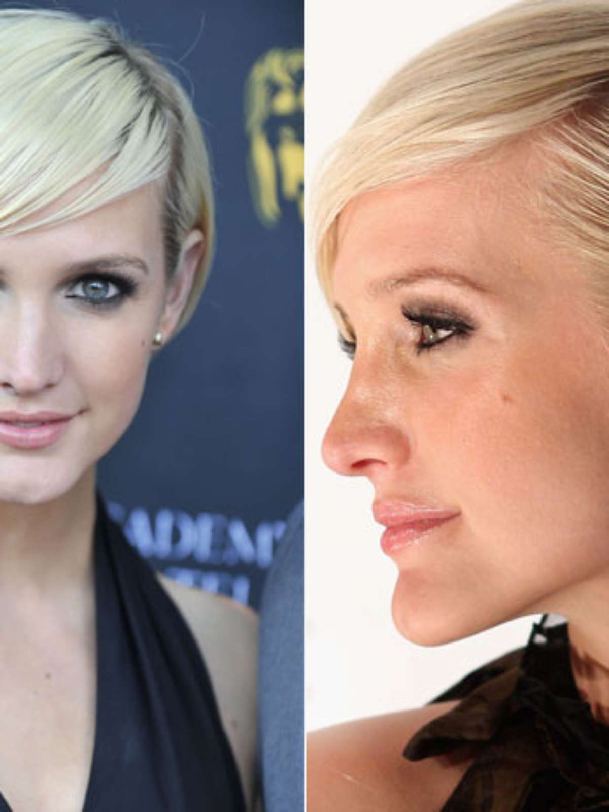 Rachel Mcadams Plastica No Nariz Antes E Depois