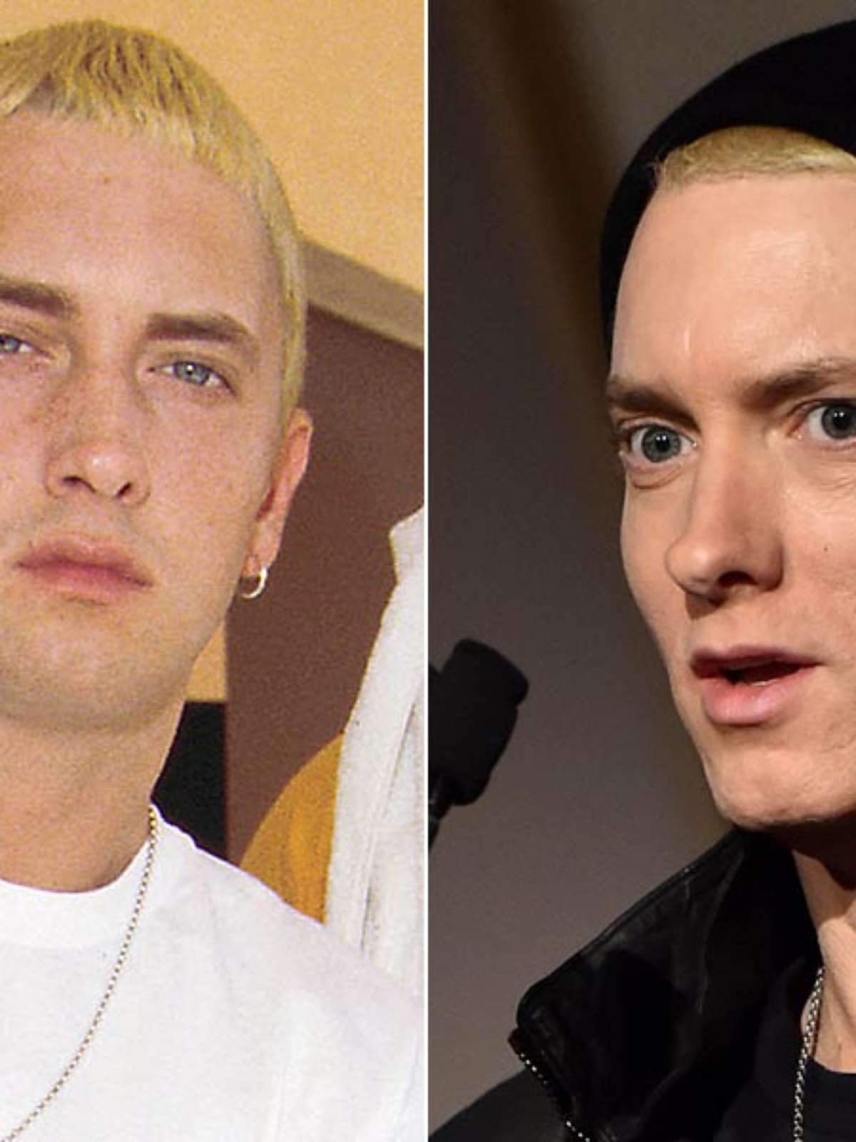 Eminem Antes E Depois Da Cirurgia Plastica