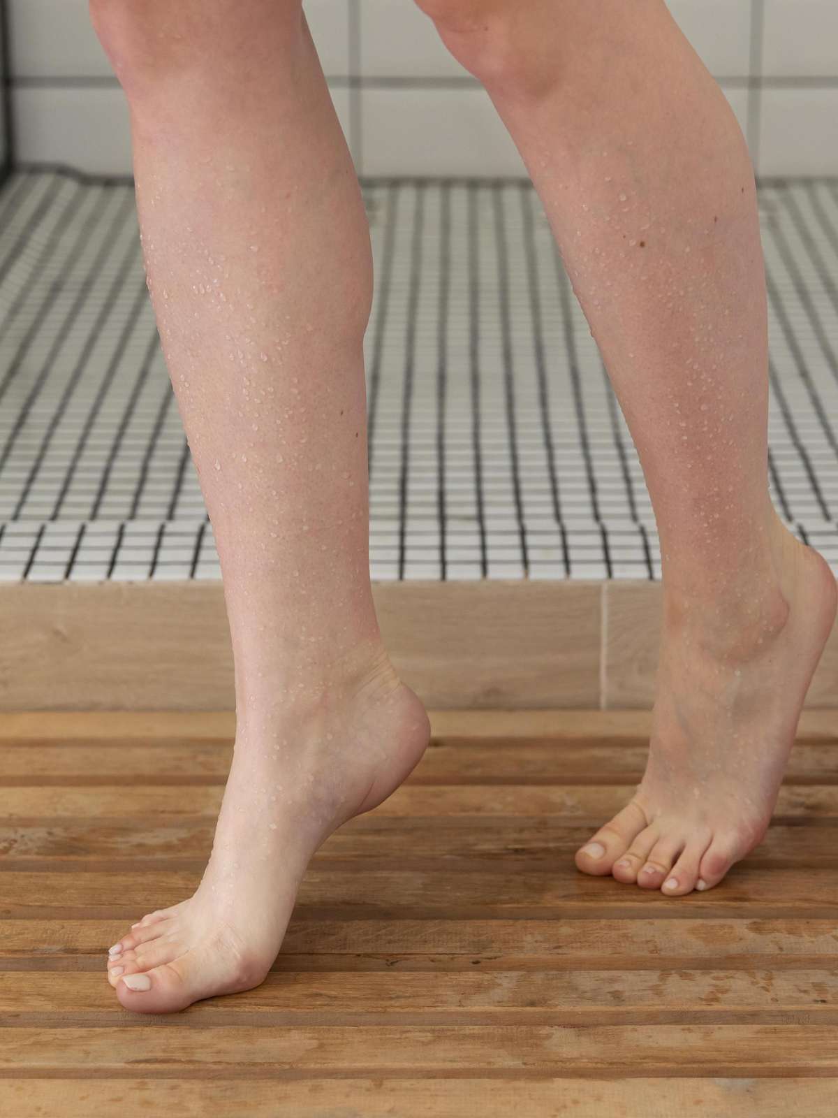 Tornozelo Inchado Feminino Entorse De Tornozelo Provoca Inchaço E Dor