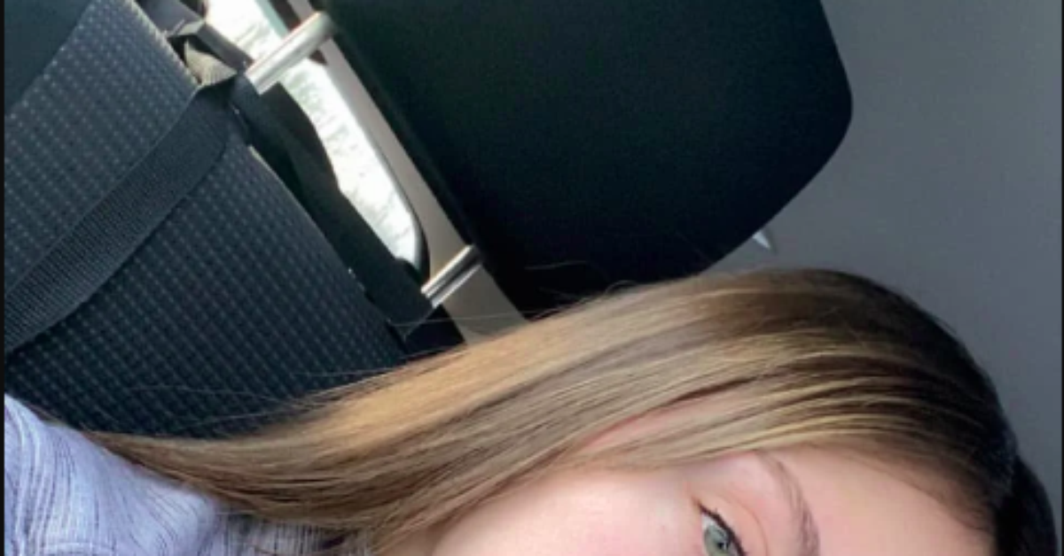 Mulher mordida por cão fica com pelo no nariz após enxerto