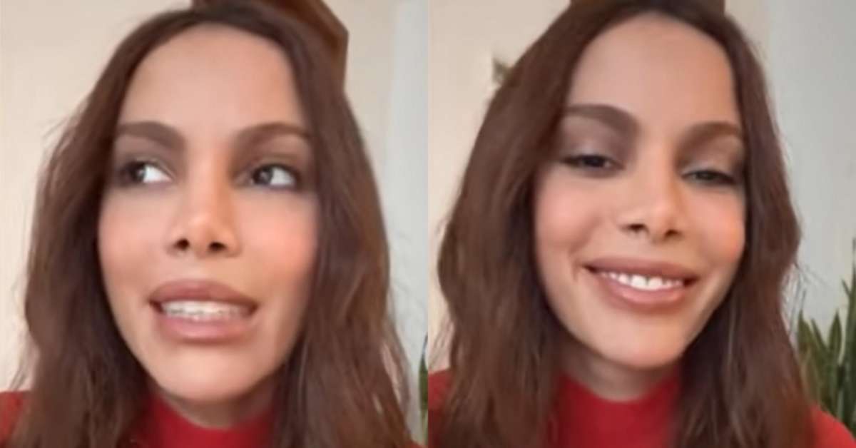 Anitta nega problemas de saúde e confirma novos procedimentos estéticos ...