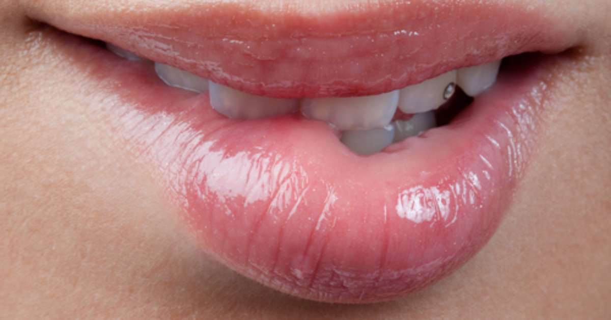 4 consejos para evitar que el herpes labial se forme