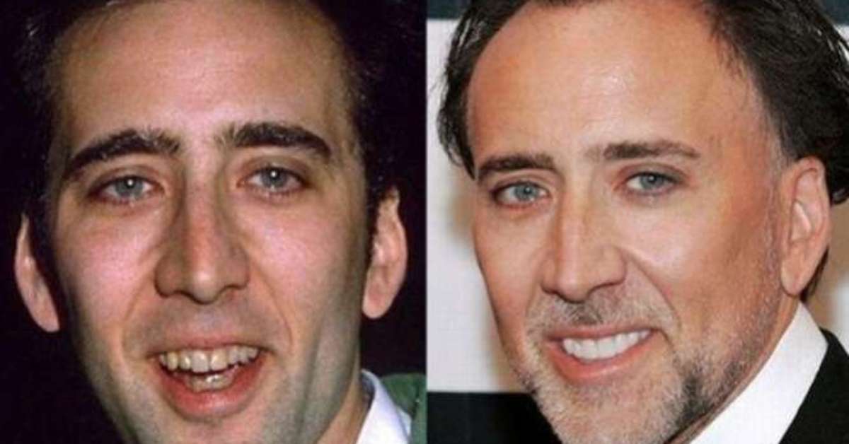 Los trucos de los famosos para lucir una sonrisa perfecta