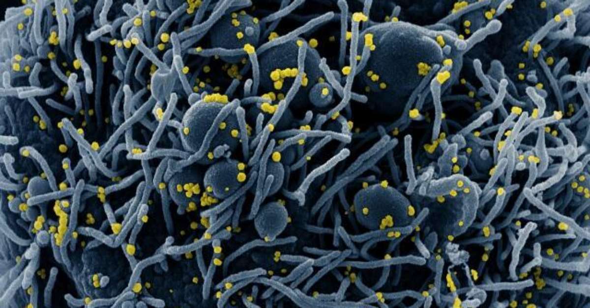 Veja uma célula infectada com o novo coronavírus
