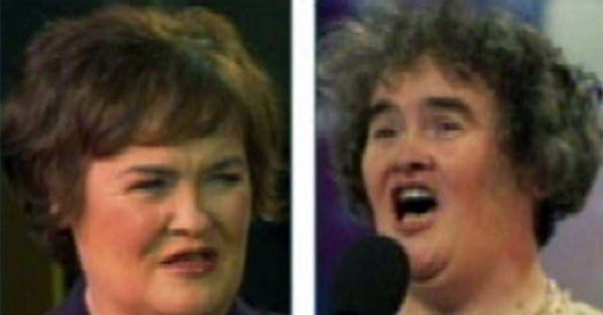 Veja o antes e o depois de Susan Boyle