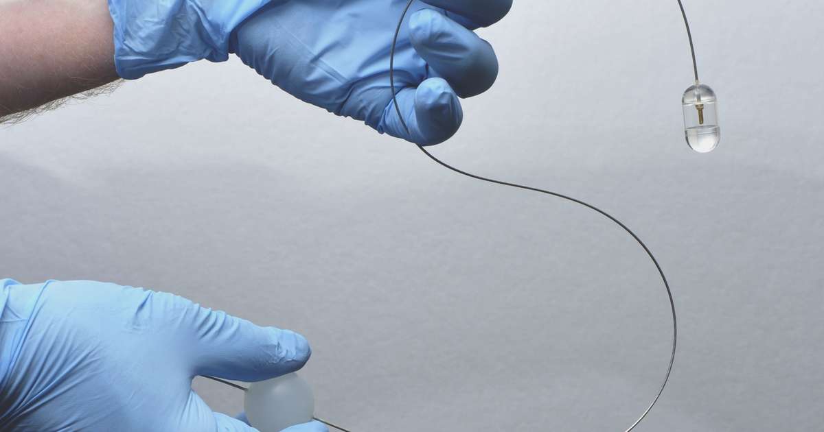 Exame "pílula" consegue detectar lesão pré-cancerígena