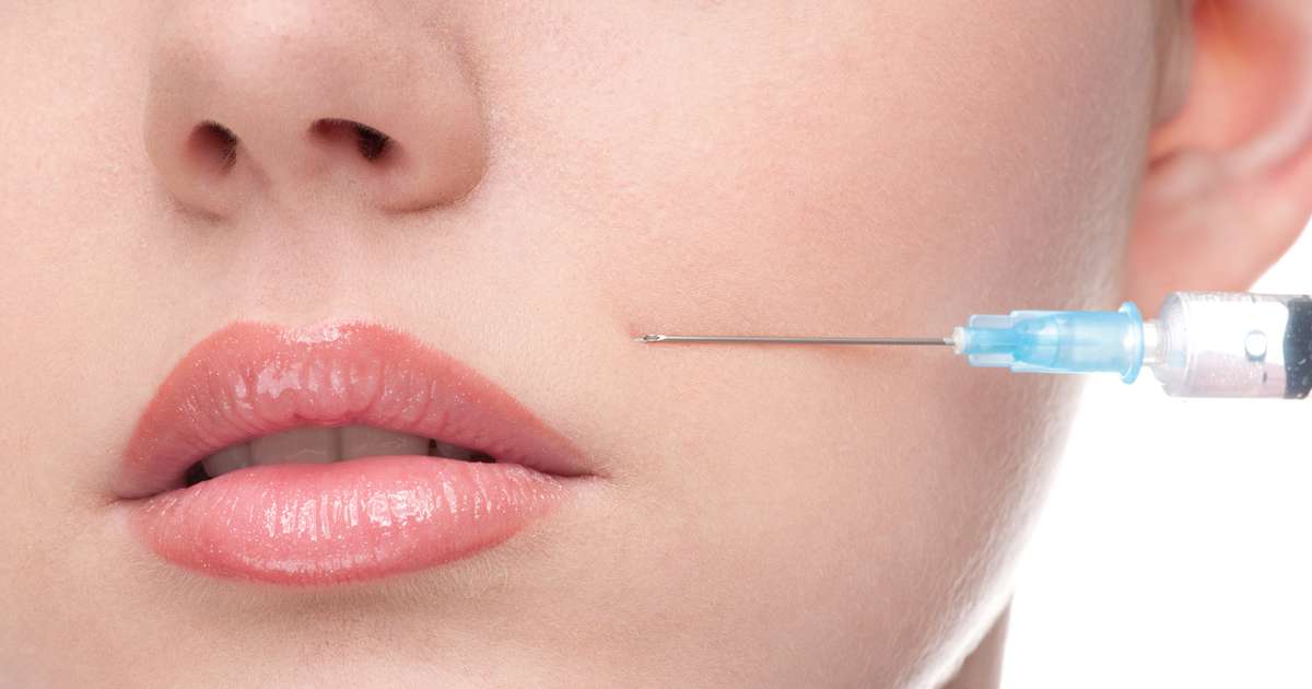 Botox pode causar sangramento e dor de cabeça; veja efeitos