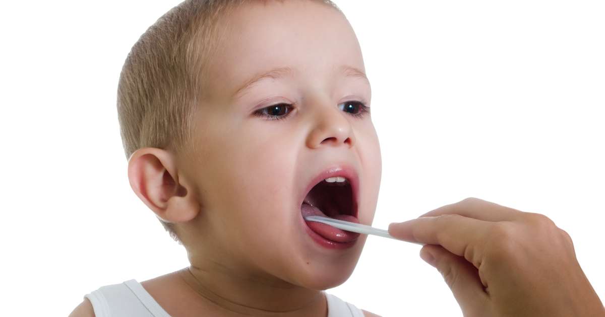 ¿Qué son y a quién afectan las paperas?