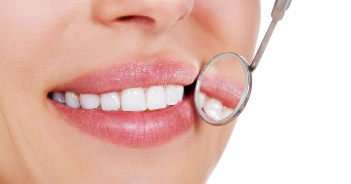 Lo que debes saber sobre el color de los dientes