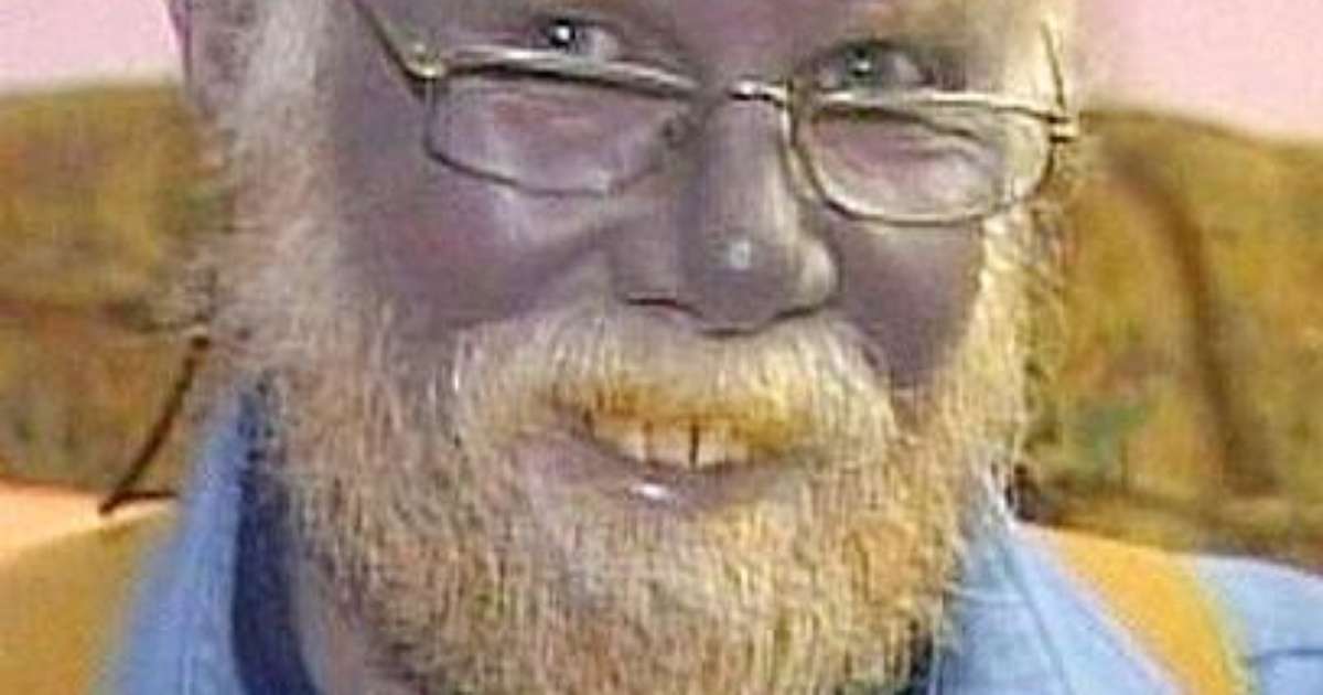 Americano apelidado de 'Papai Smurf' por ter pele azul morre aos 62 anos