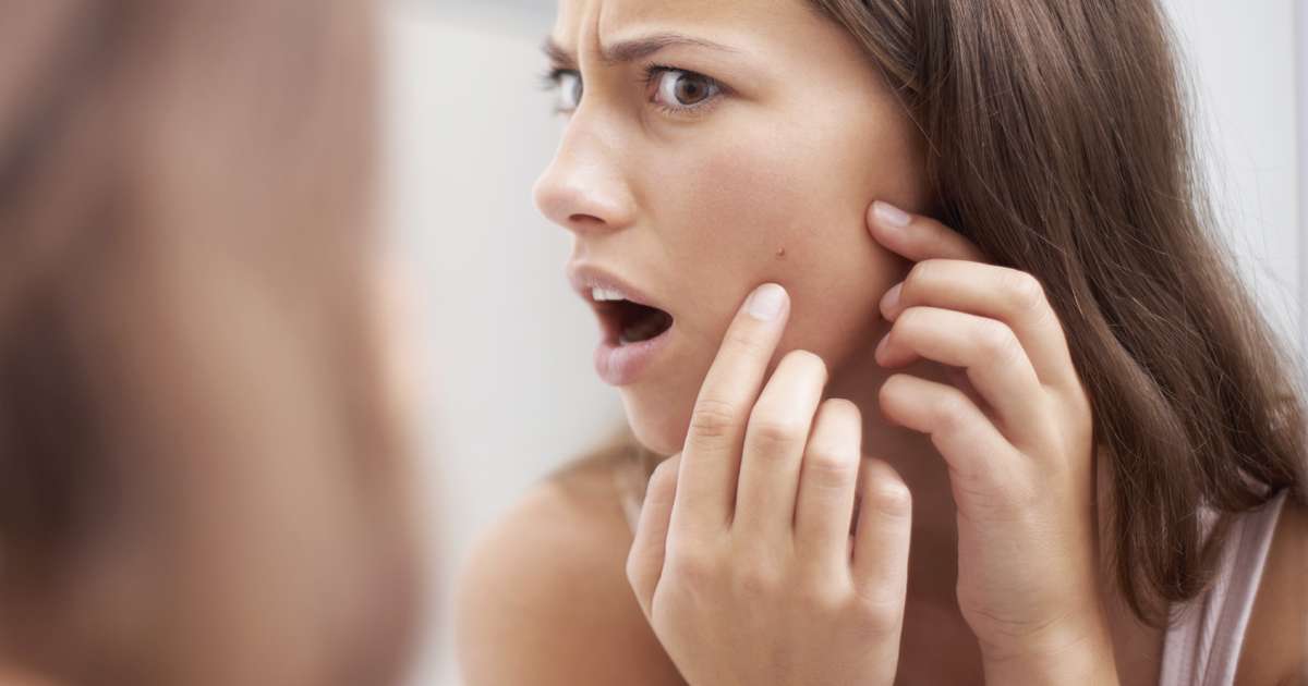 Ai! Veja lugares onde as espinhas aparecem de "surpresa"