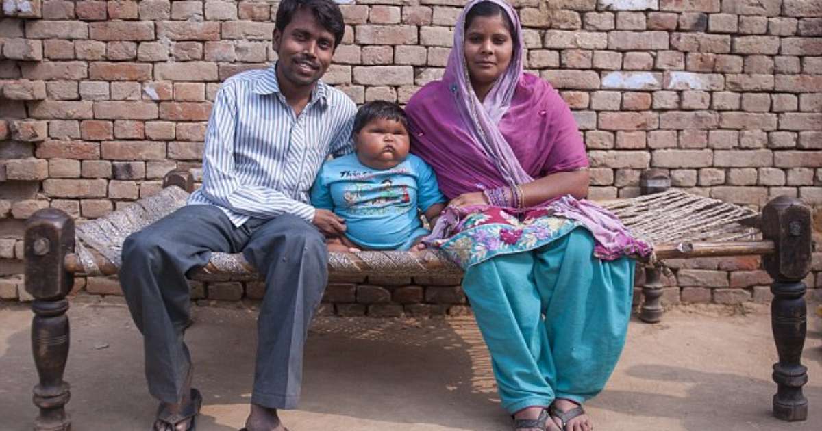 Bebê indiano de 10 meses pesa 20 quilos e preocupa família