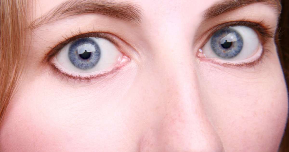 Exoftalmia: Saiba quando olhos saltados são motivo de preocupação