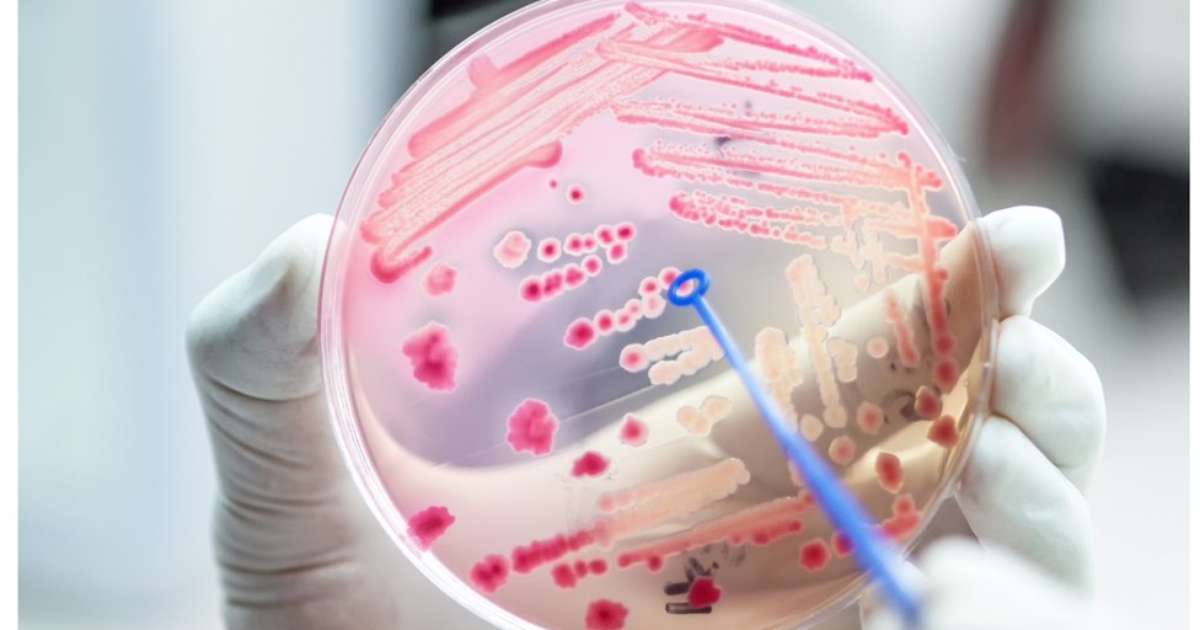 Como domamos os micróbios antes que eles nos dominassem