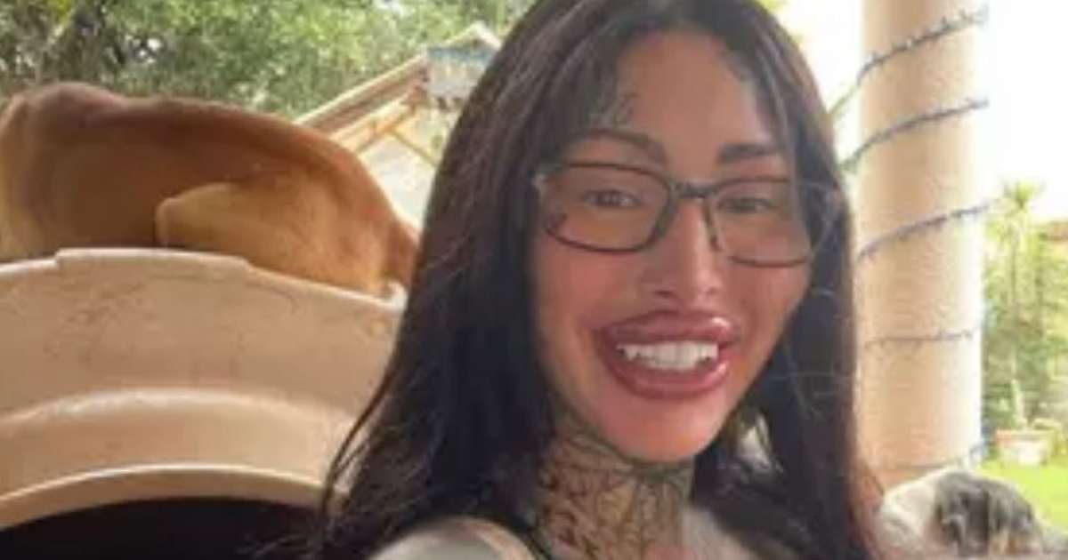 Influencer 'viciada em plásticas' quase morreu para bater recorde inusitado
