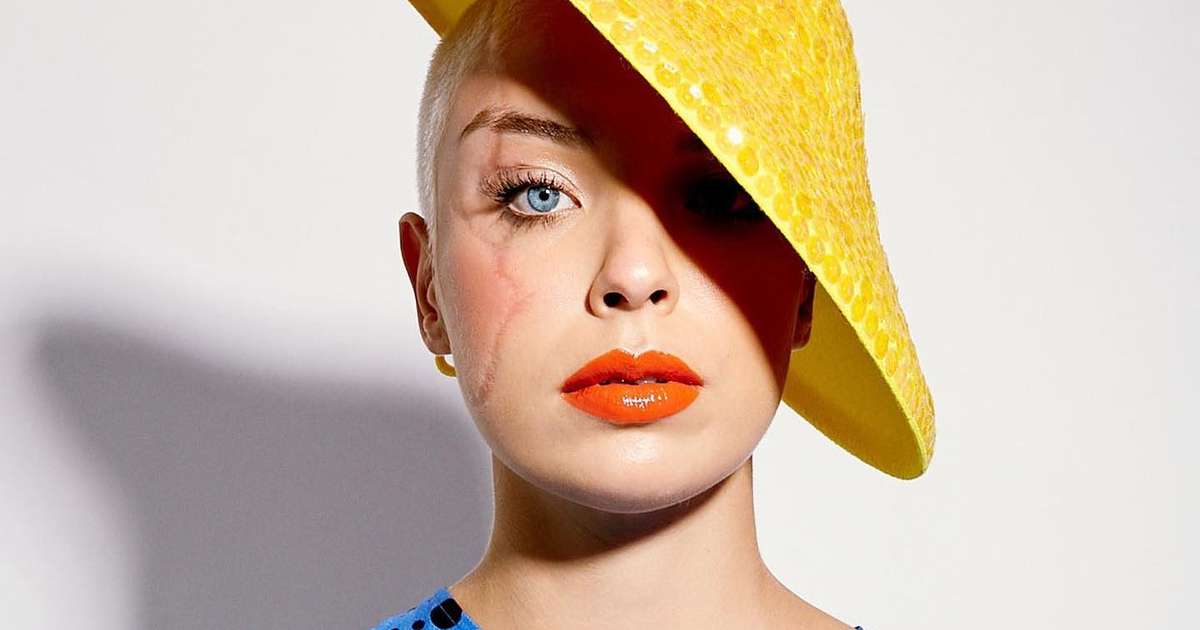 "Olhares curiosos incomodam", afirma modelo com cicatrizes