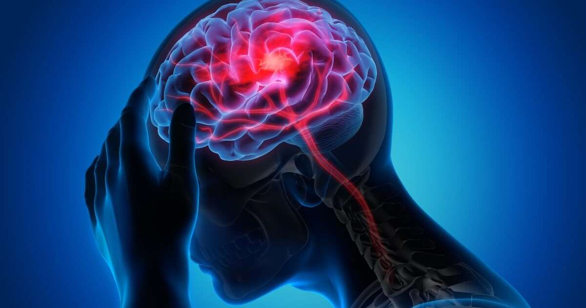 Epilepsia: mitos e verdades sobre a condição neurológica