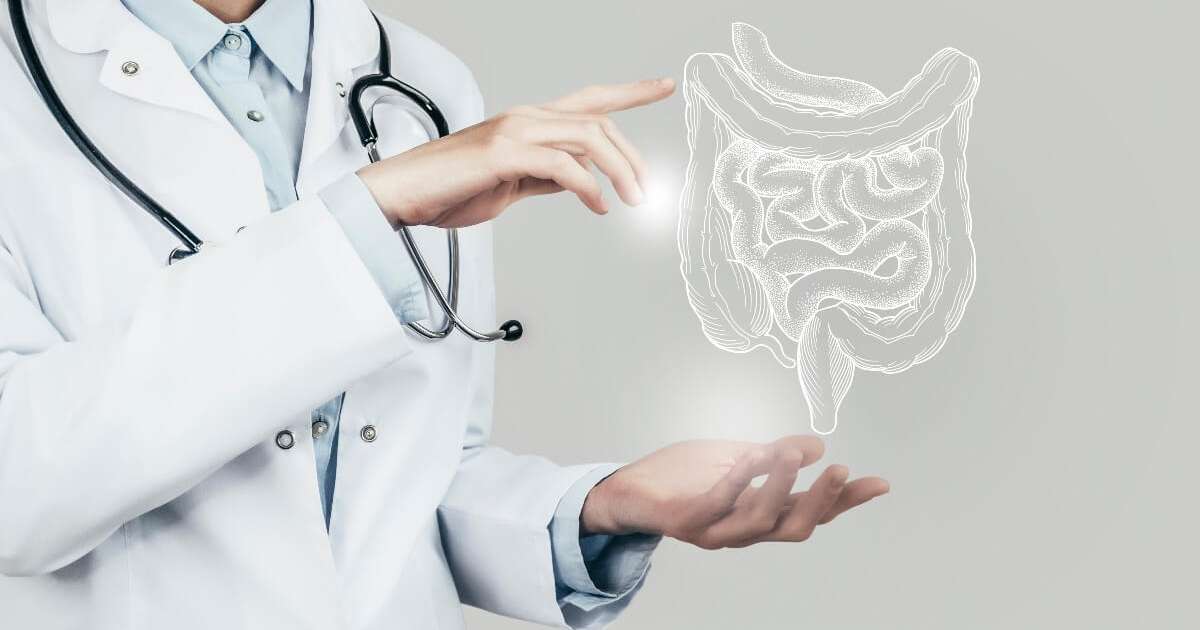 Estudo indica como ocorre a recaída do câncer colorretal e pode ...