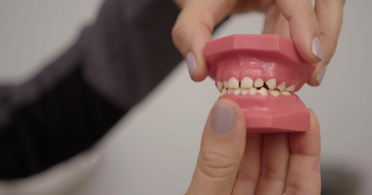 Tipos de mordida: como identificar e tratar a mordida profunda em ...