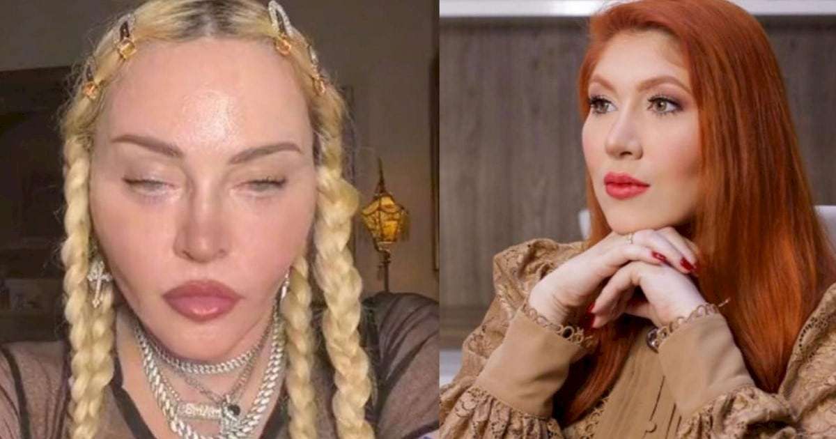 "Madonna vai gastar fortuna para reverter plásticas", diz Nayane Vianna