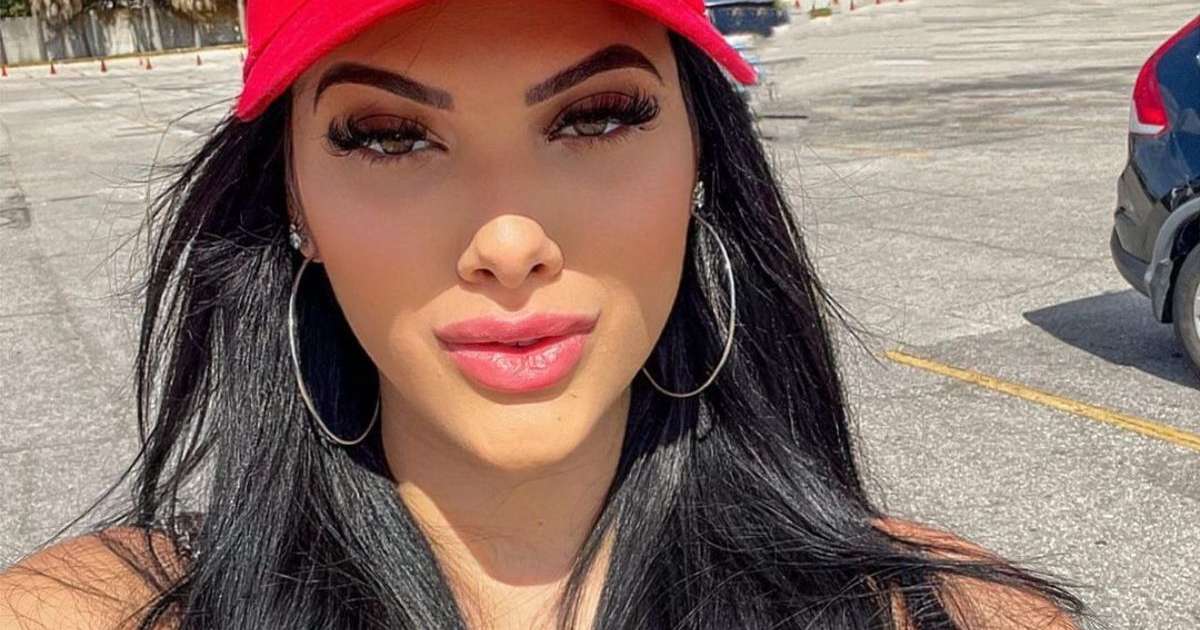 Emily Garcia perde lente de contato em um dos olhos. O que fazer?