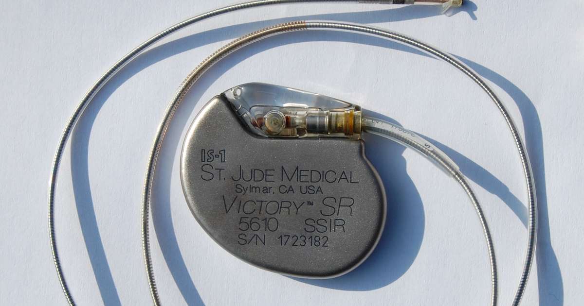 Como funcionam os marcapassos?