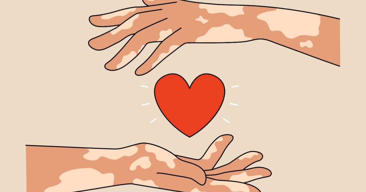 Entenda o que é a hanseníase e conheça os sintomas