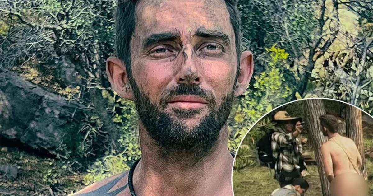 Participante de reality sofre acidente íntimo com fogueira