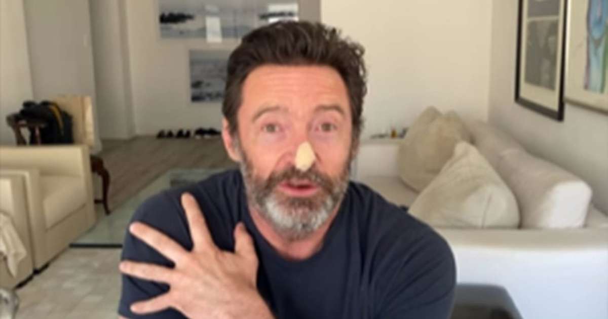 Hugh Jackman faz novas biópsias por suspeita de câncer de pele