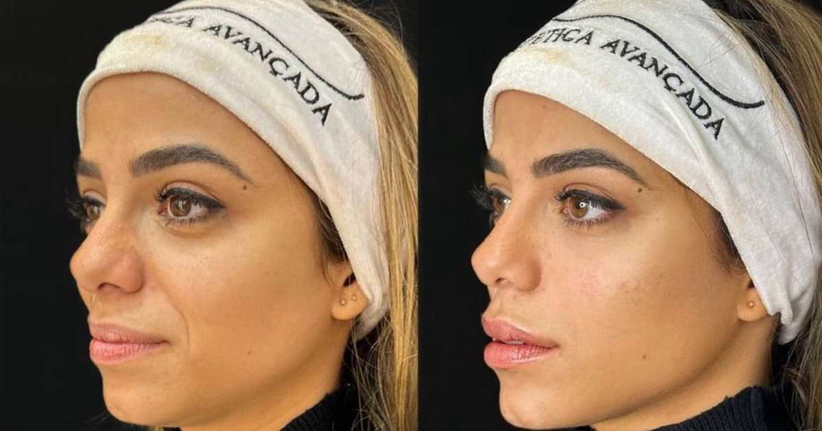 Ex-BBB Key Alves faz harmonização facial e surpreende web: 'Ficou igual ...