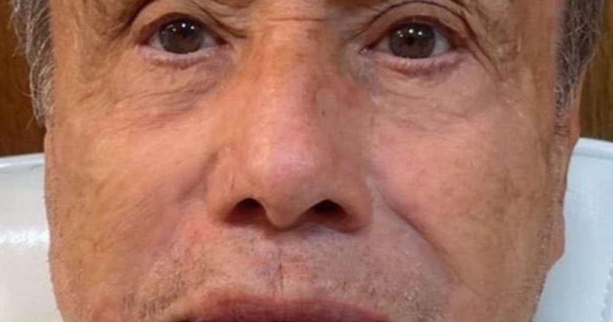 Stênio Garcia faz harmonização aos 91 anos e viraliza: "Gretchen sem ...