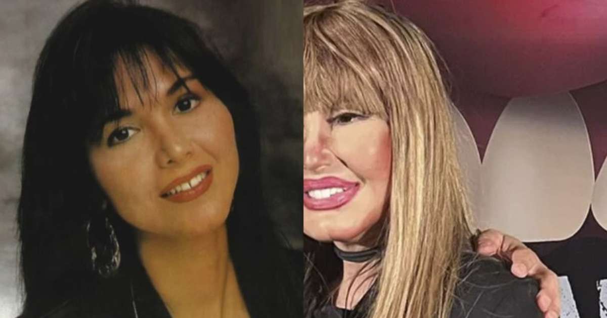 Hit dos anos 80, Rosana surge irreconhecível e com o rosto inchado