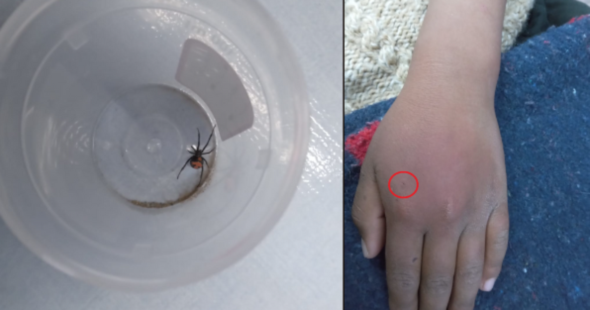 Menino de 8 anos é picado por viúva negra ao tentar virar Homem-Aranha