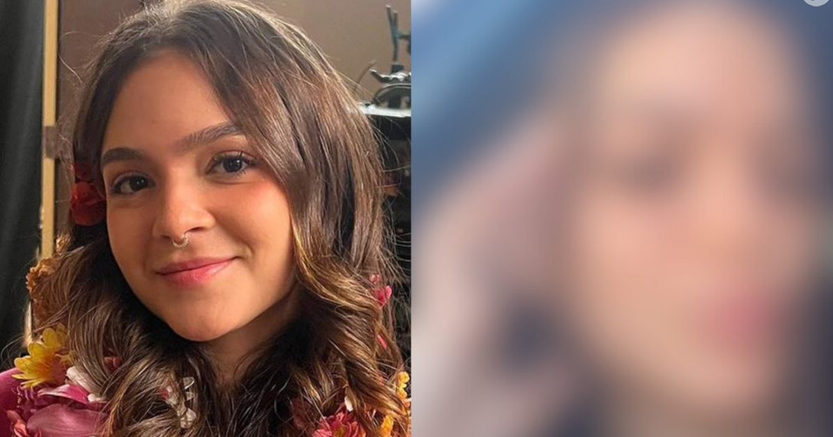 Mel Maia é acusada de fazer preenchimento labial e fãs desaprovam ...