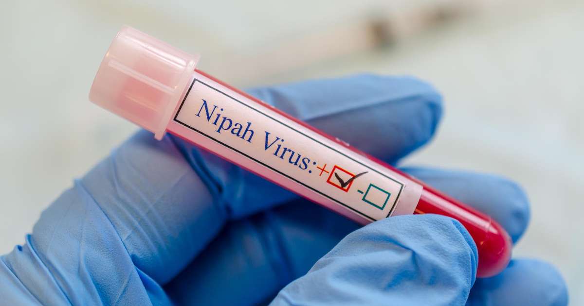 Nipah Como Surgiu O Vírus E Como é A Forma De Transmissão