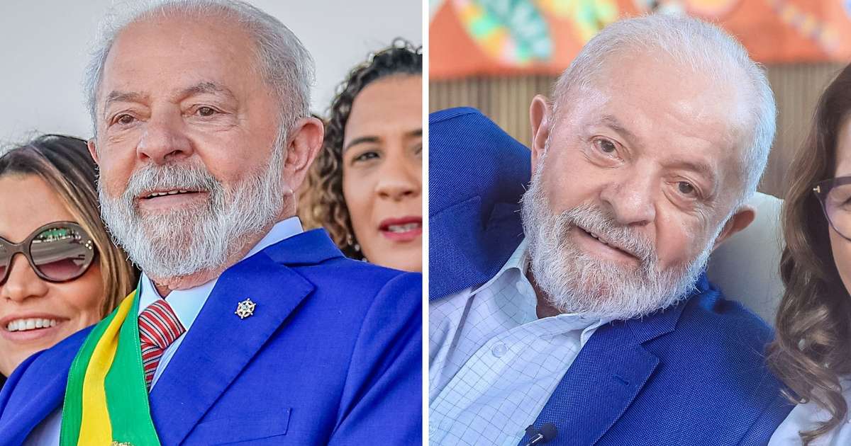 Veja antes e depois de Lula após cirurgia plástica