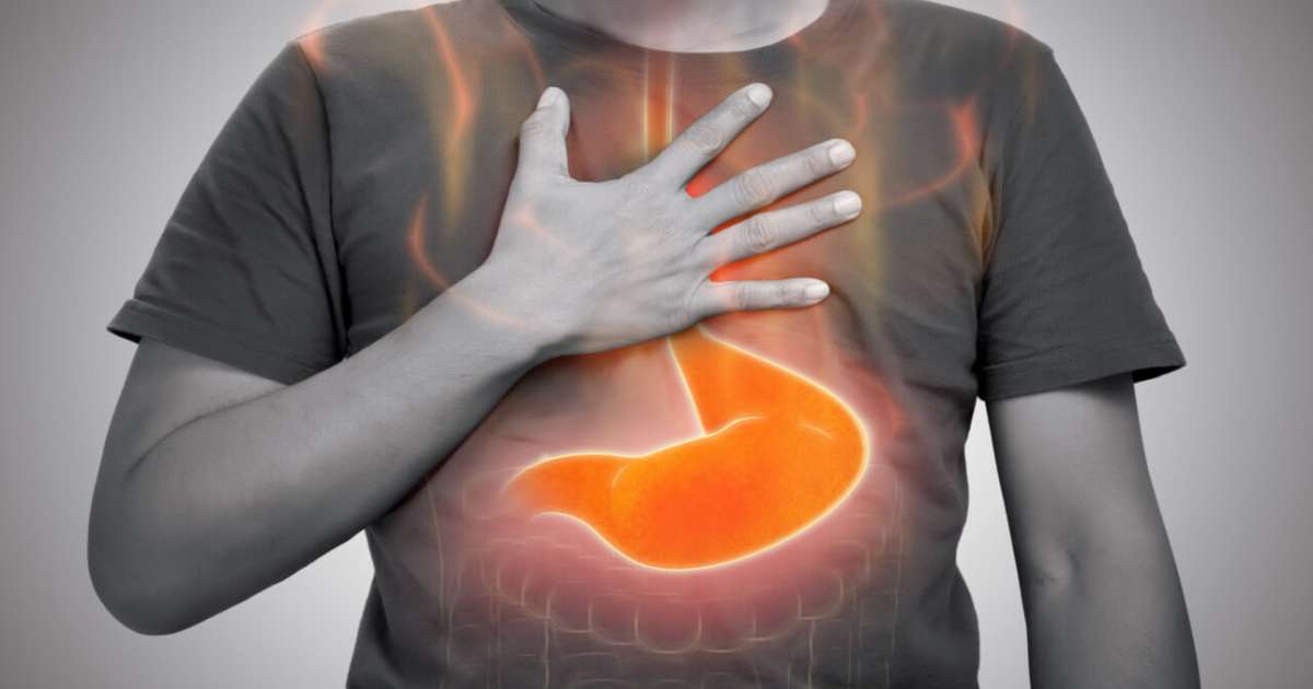 Refluxo: sintomas, causas e tratamento