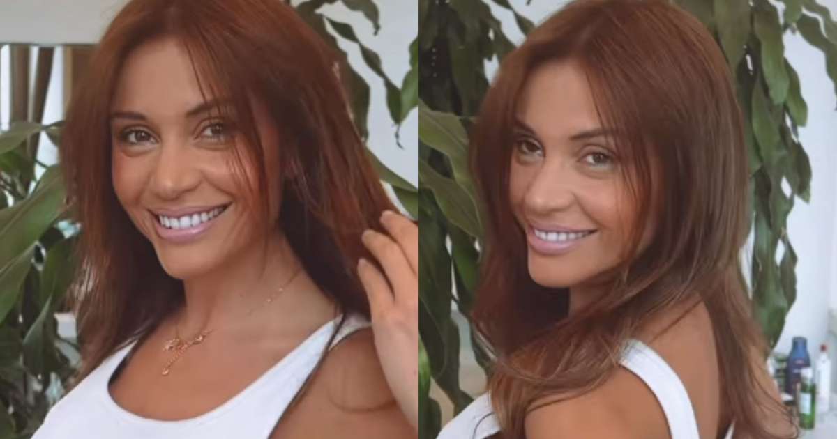 Maria Melilo, campeã do 'BBB 11', mostra hematomas após agressão do ...