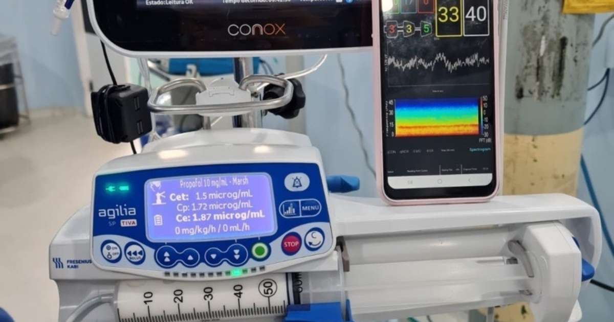 Chega ao Brasil novo aparelho de monitoramento de anestesia