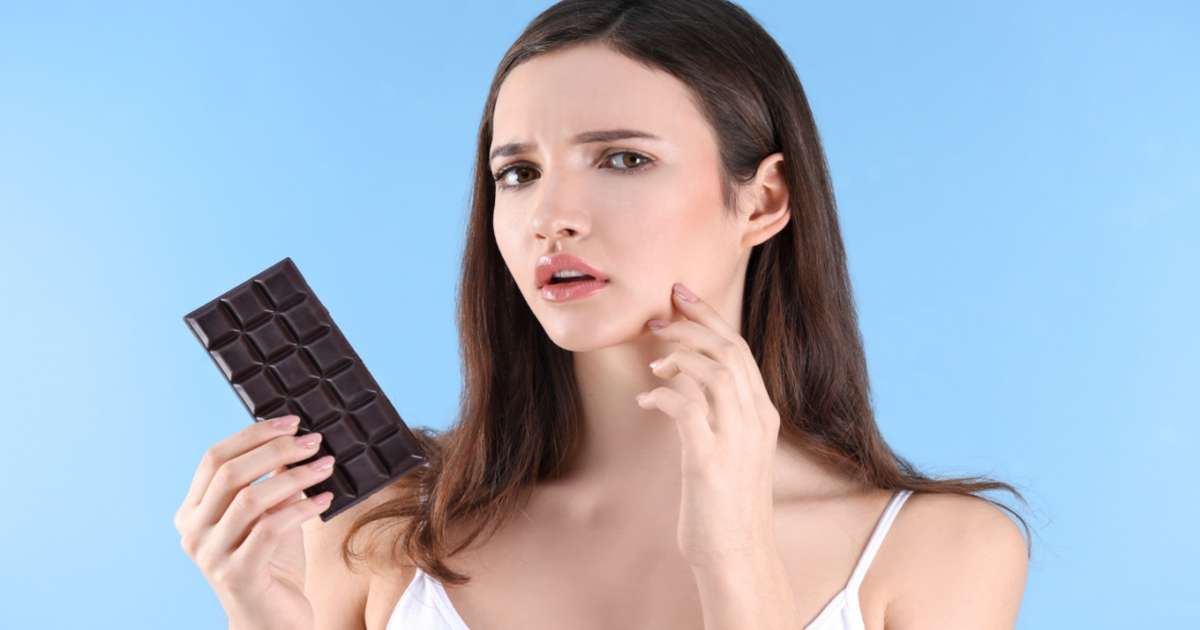 Páscoa: chocolate causa espinhas? Dermatologista explica