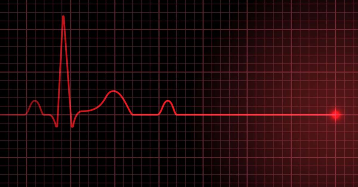 Parada cardíaca: o que é, causas e consequências