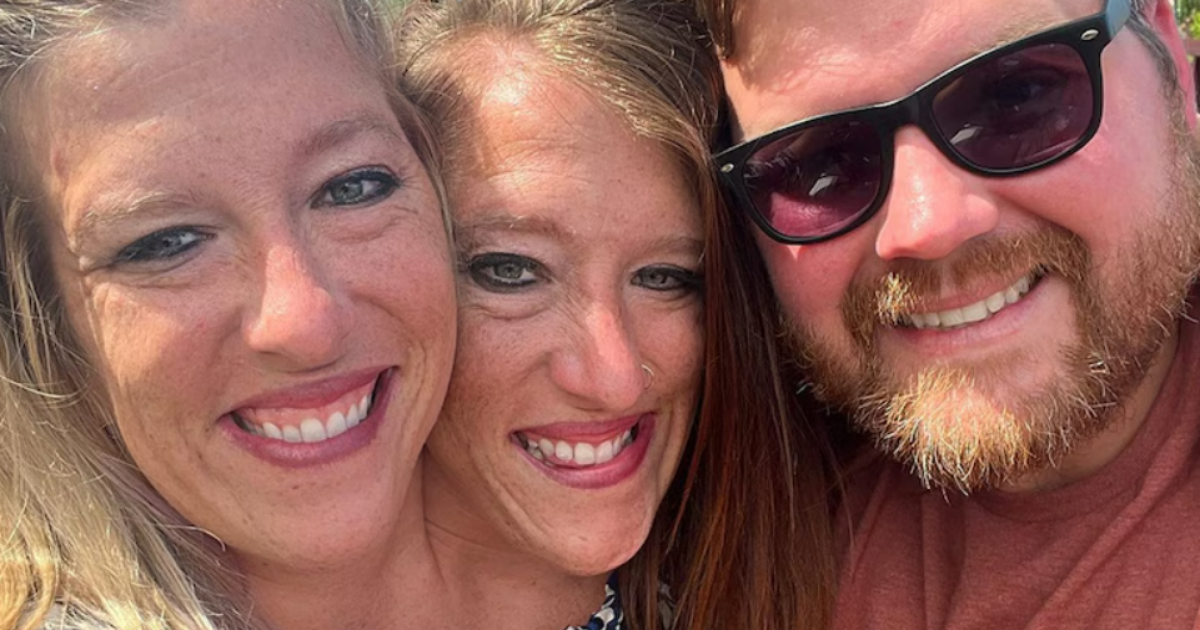 As polêmicas do relacionamento de gêmea siamesa que se casou unida a irmã