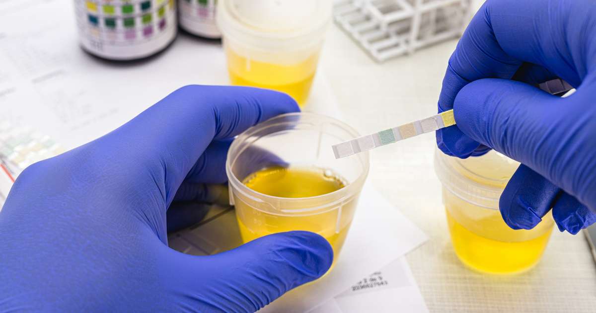 Xixi Transparente é Normal - RETOEDU