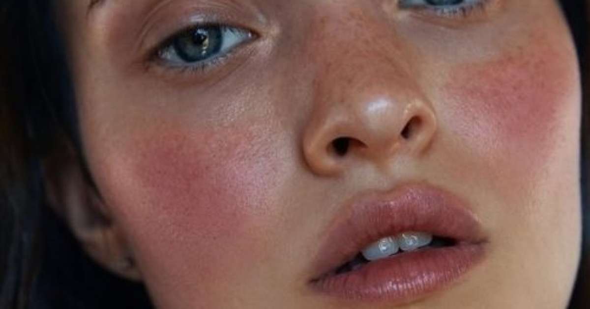 Boyfriend blush: 5 dicas para aderir à tendência