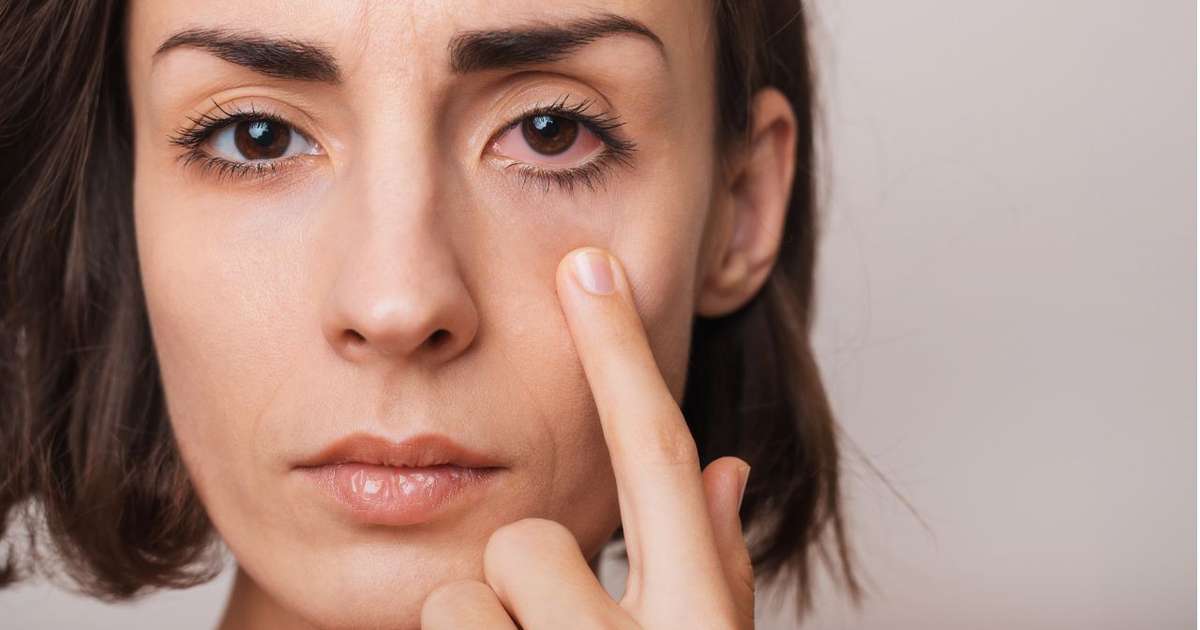 Glaucoma: conheça as causas, sintomas e tratamento