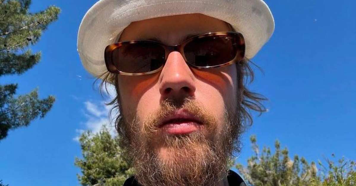 Diogo Defante mostra resultado de cirurgia na pálpebra em novo clipe ...