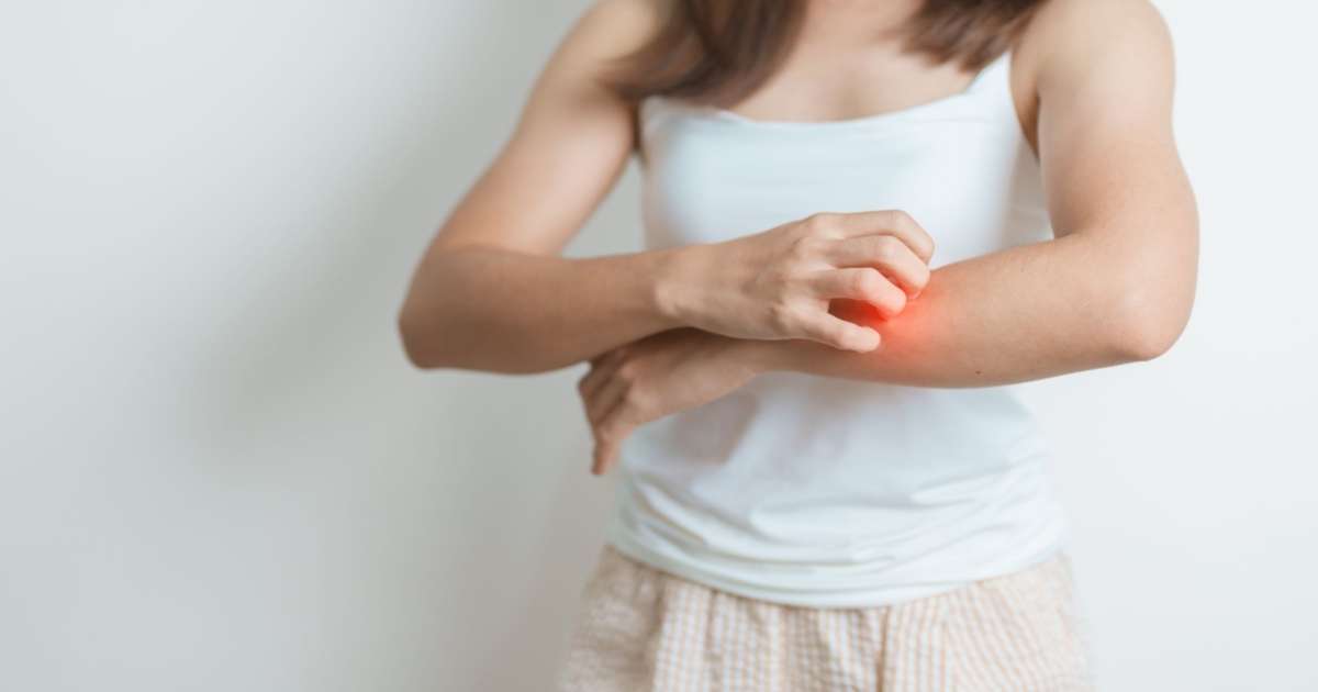 Quais são os sintomas de Lúpus? Entenda mais sobre a doença autoimune