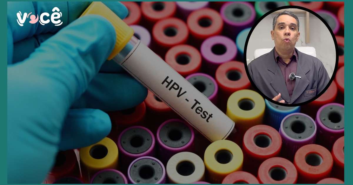 HPV pode influenciar o surgimento de câncer de cabeça e pescoço