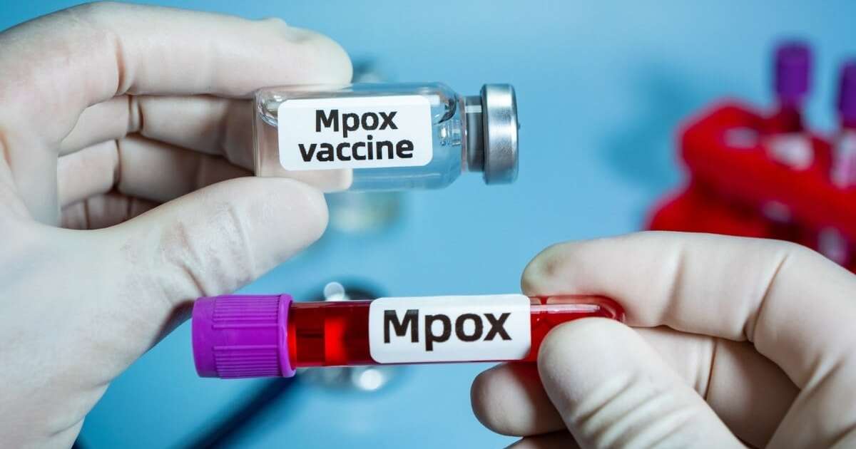 8 perguntas e respostas sobre a Mpox