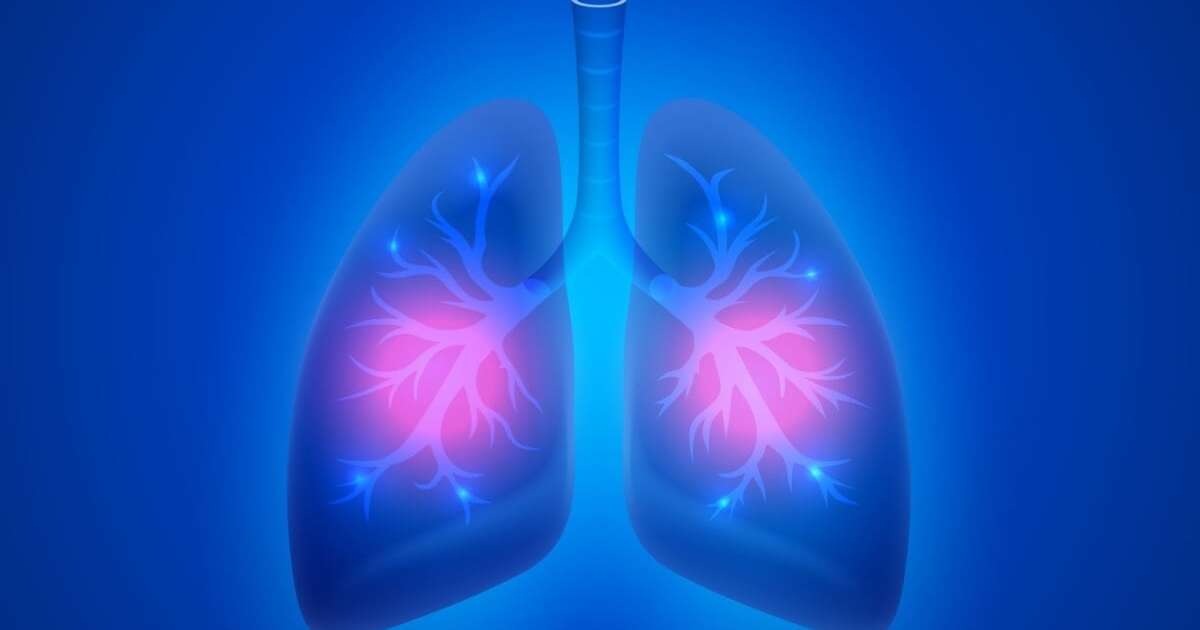 Sintomas de pneumonia, quais são? Descubra!
